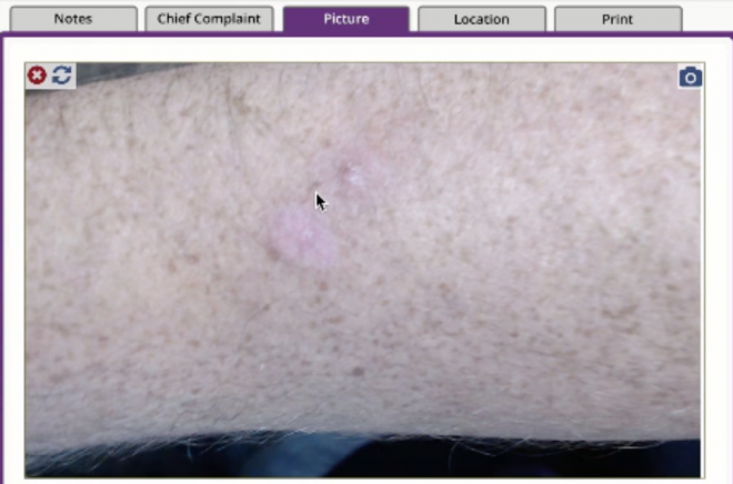 AcuGraph 5 Video Training: Capturing Live-photos in AcuGraph
