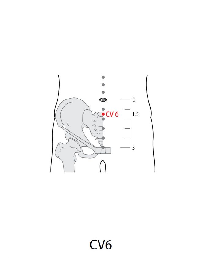 Acupuncture Point: Conception Vessel 6 (CV 6) - Acupuncture Technology News
