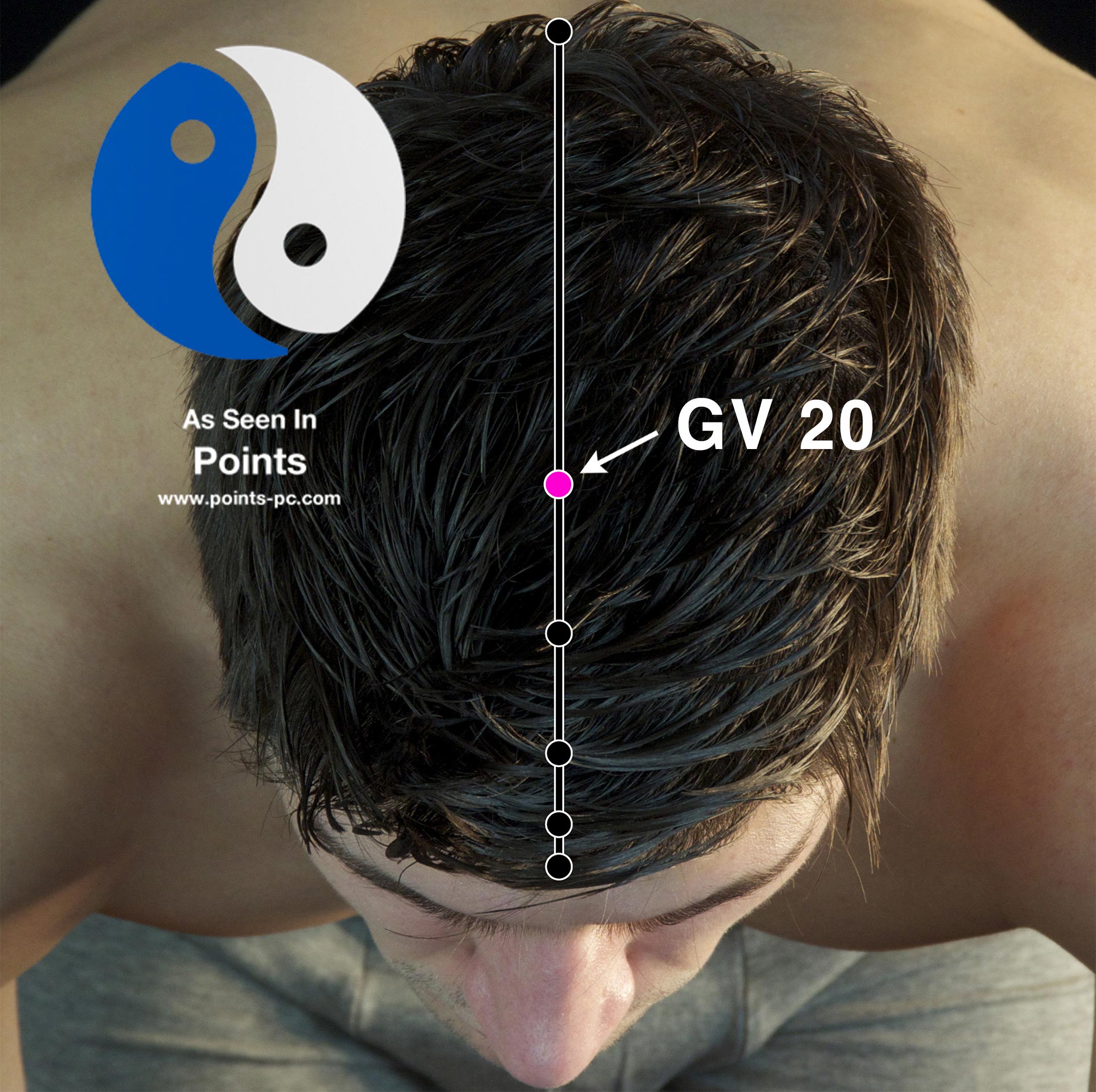 Acupuncture Point: Governor Vessel 20 - Acupuncture Technology News