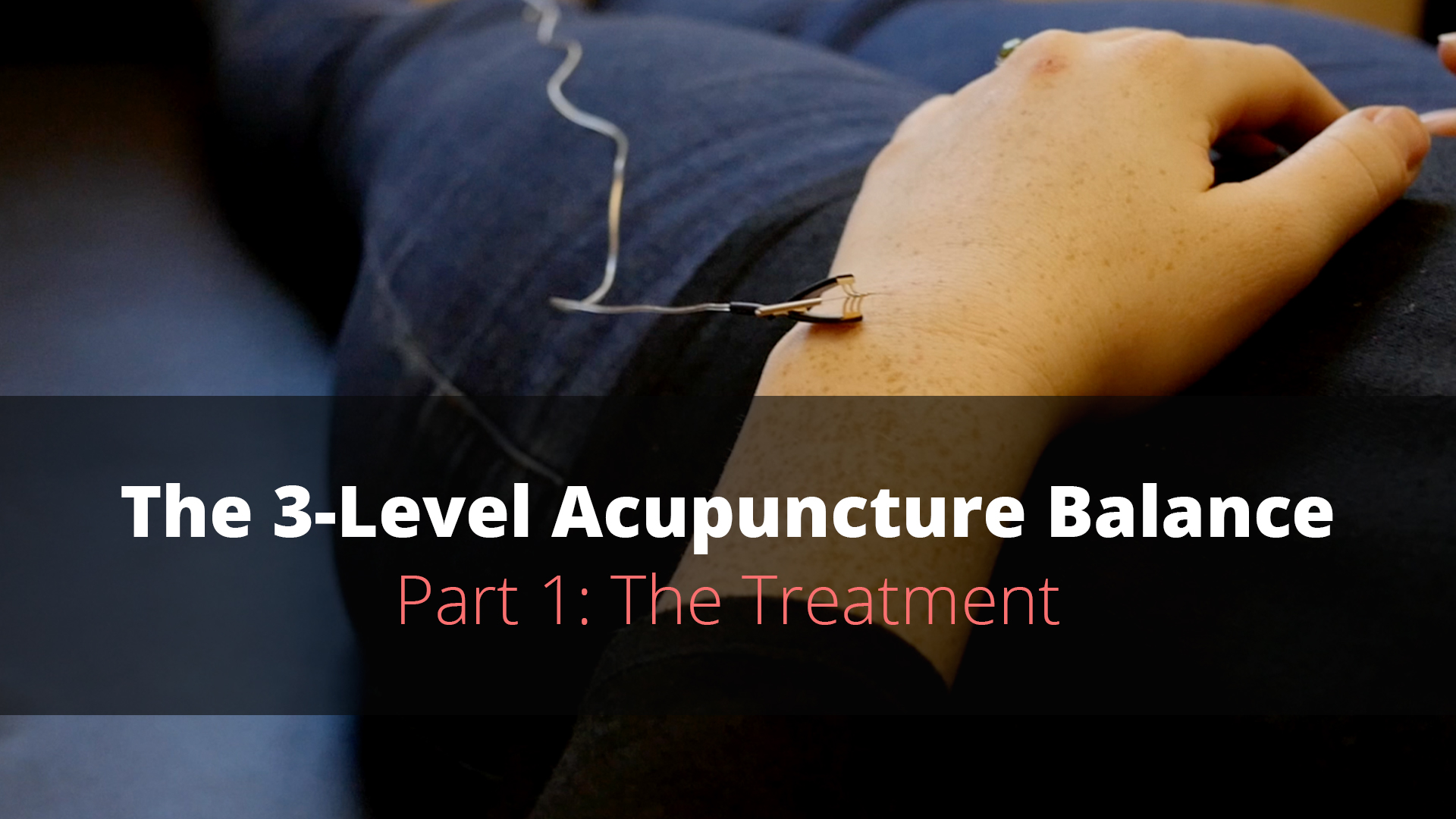 The 3-Level Acupuncture Balance: Part 1-The Treatment